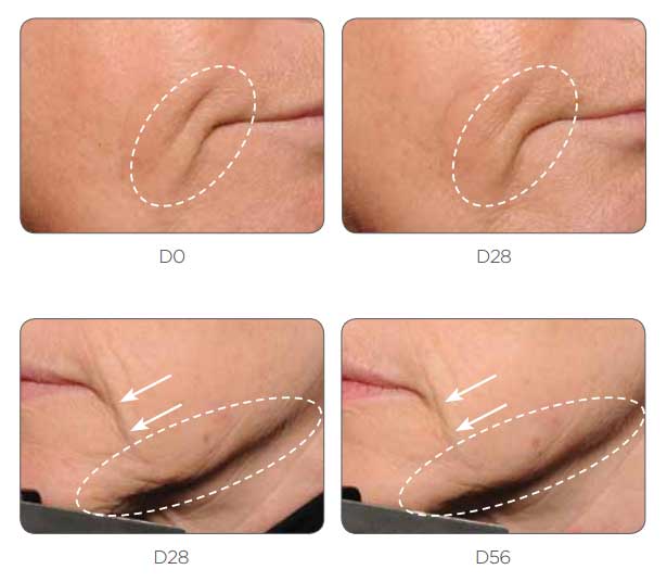 CharaOmni 15 ML - 60 Applications – Chara Biologics